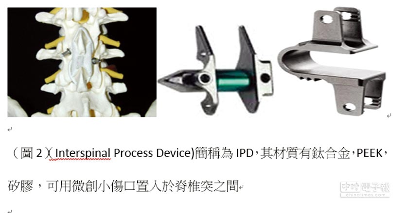 名．醫．問．診－脊椎疾症治療 新趨向 - 產業特刊 - 工商時報