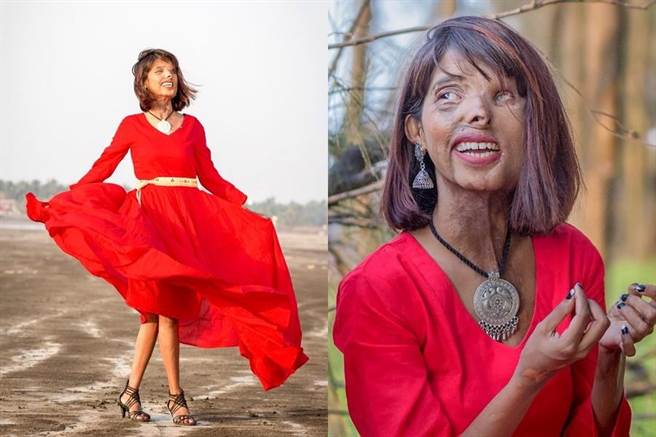 曾遭父親潑酸整臉融化 她做這件事復仇 - 日常 - 網推