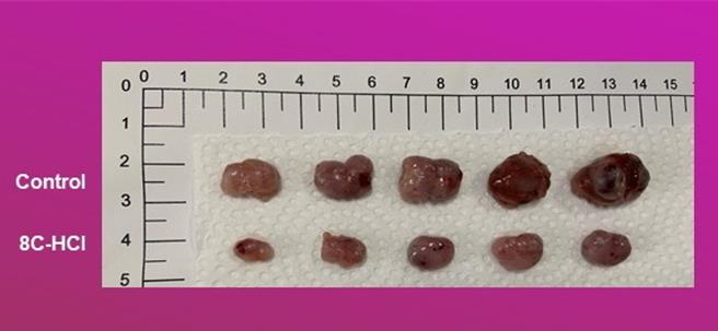 膀胱癌曙光！台灣新藥「8C」出爐 多種癌症也有療效 - 健康 - 中時